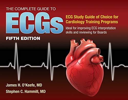 Complete Guide to ECGs: A Comprehensive Study Guide to Improve ECG ...
