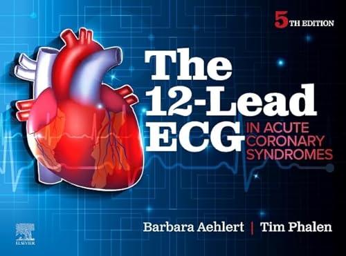 12-Lead ECG in Acute Coronary Syndromes - STANZATEXTBOOKS